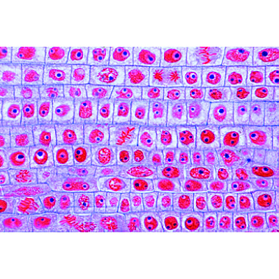 Mitosis and Meiosis Microscope Slide Sets - LabWorld.co.uk